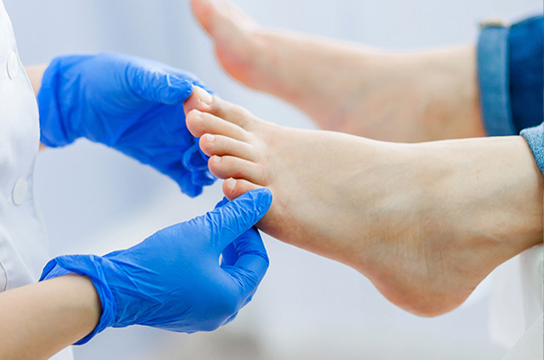 Podiatrist in North Miami Beach | Foot Doctor North Miami Beach | Foot ...